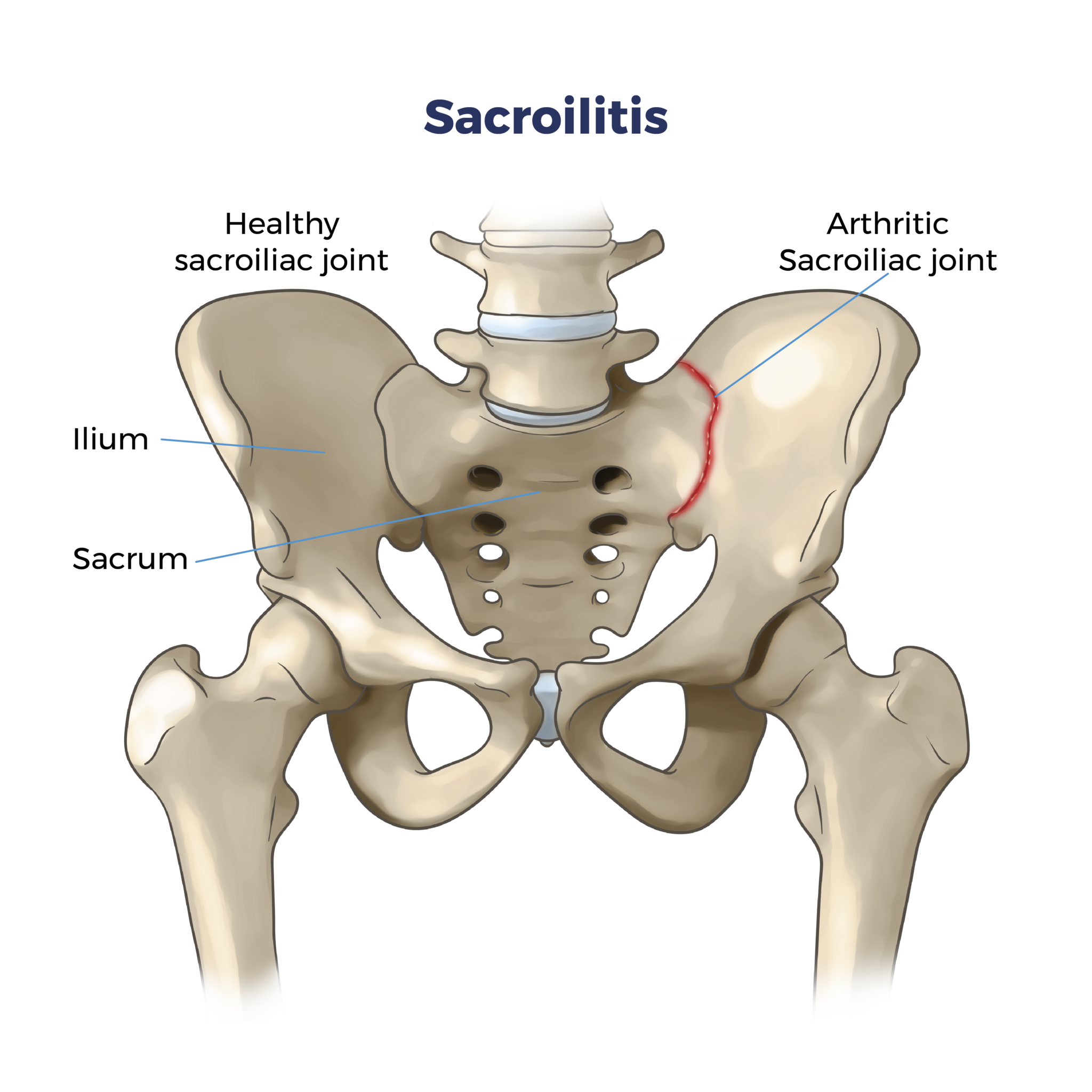 Conditions We Treat – arvcenters