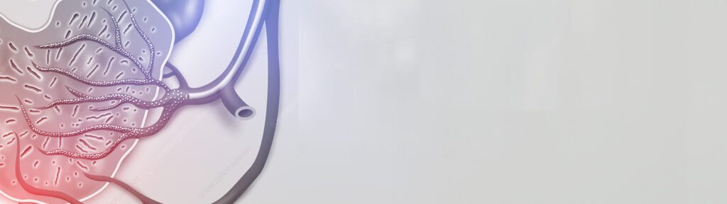 Prostate Artery Embolization For Bph Arvcenters