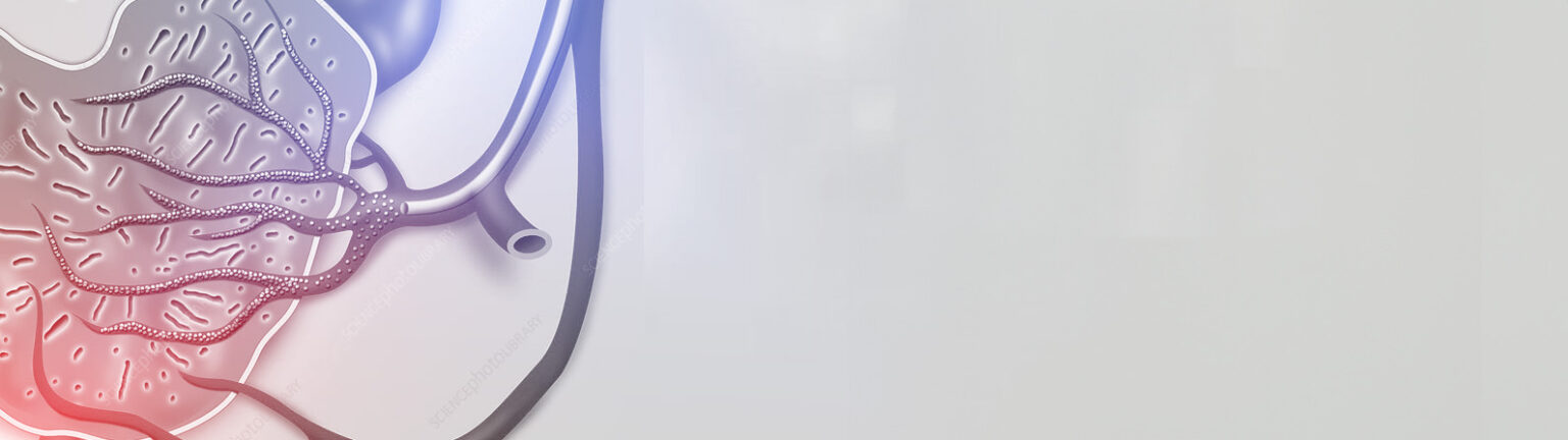 Prostate Artery Embolization for BPH – arvcenters